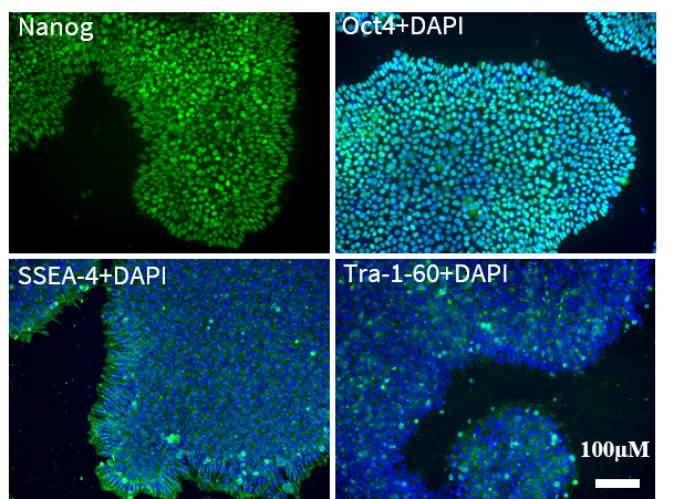 RCRP005N - StemRNA Human iPSC 771-3G