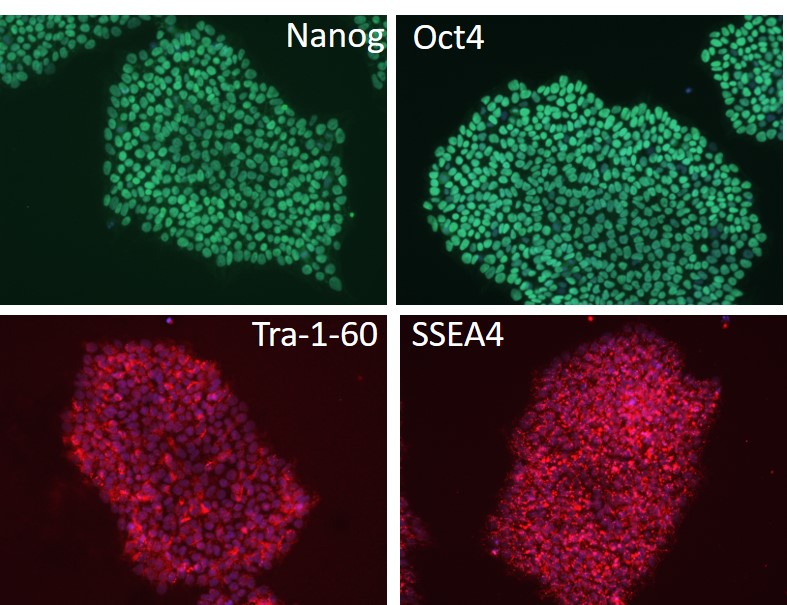 RCRP007N - StemRNA Human iPSC SK004.2