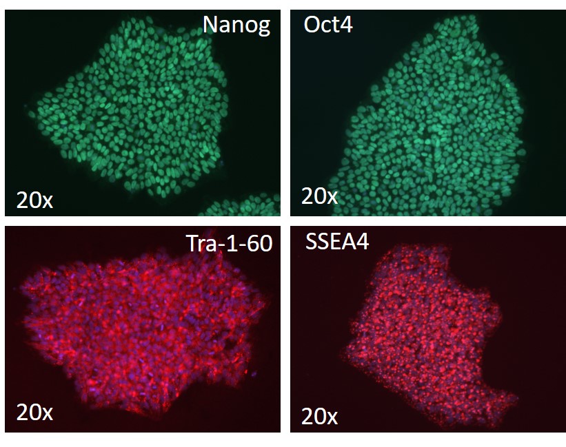 RCRP009N - StemRNA Human iPSC BL003