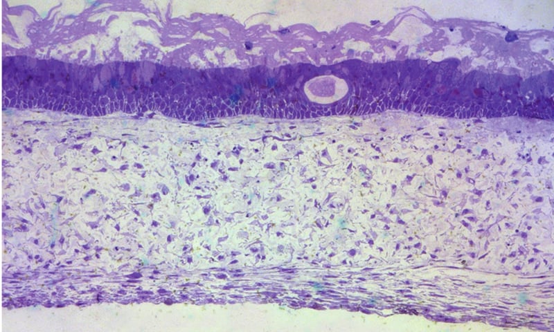 3D Human Airway Mucosa Model Research And Assays