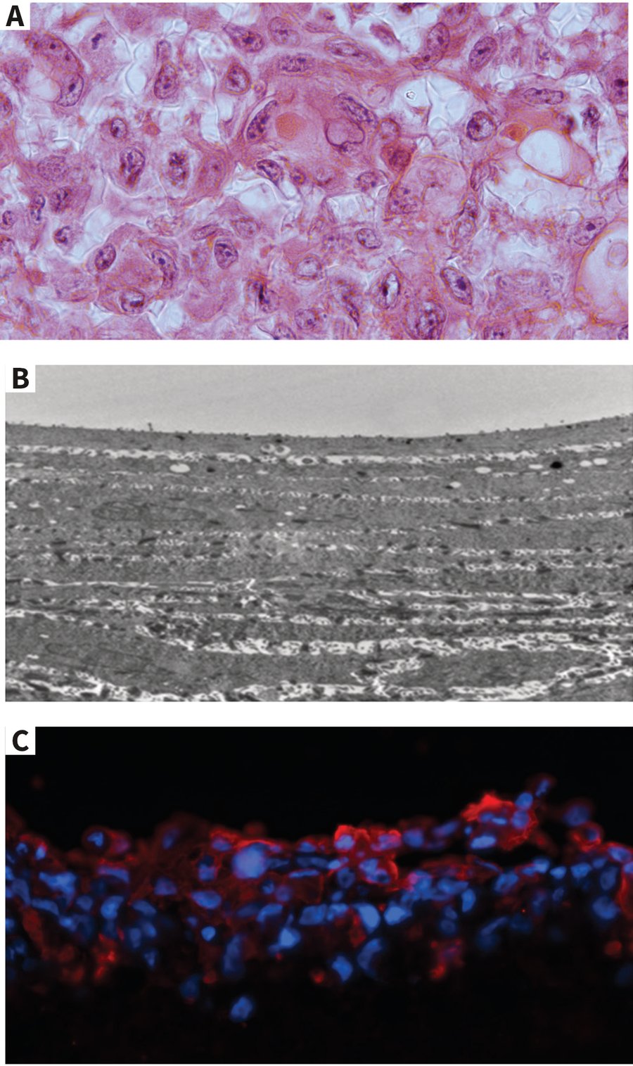 Confocal Microscopy and Alvetex Scaffold