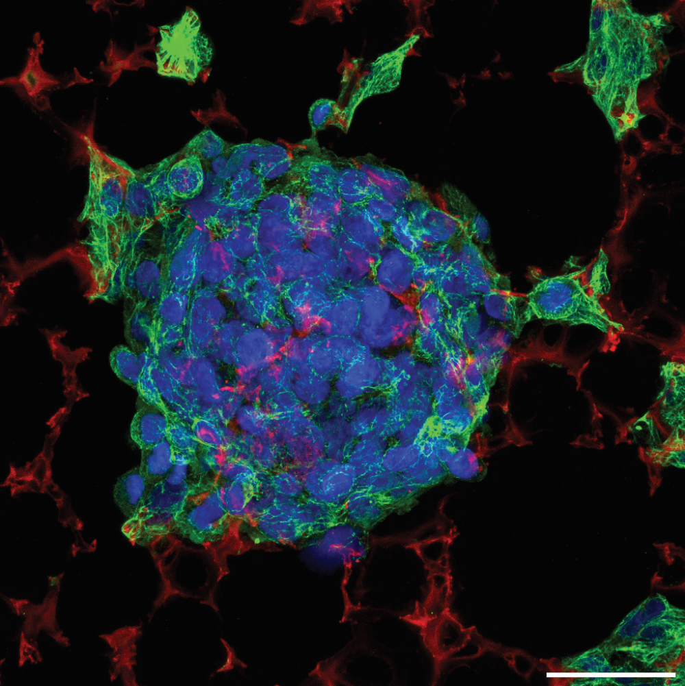 Confocal Microscopy and Alvetex Scaffold