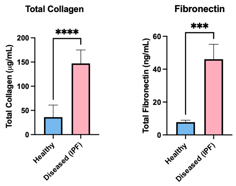 Bioengineered 3D Human IPF Models & Cell Culture Solutions