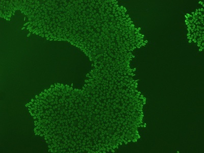 Protocol for immunocytochemistry of stem cells
