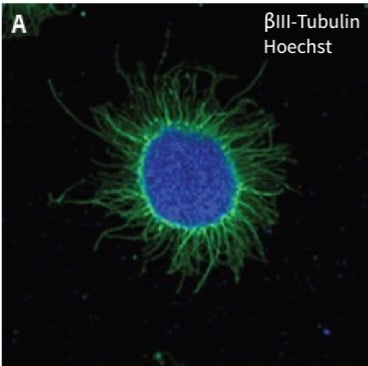 Neurite Outgrowth Assays using StemRNA Neuro