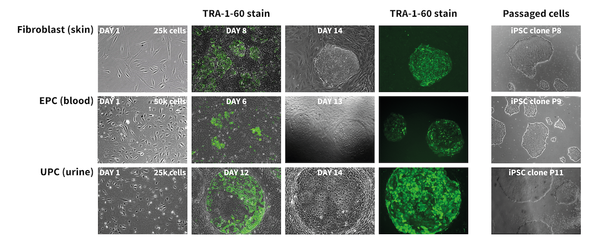 Five reasons to choose StemRNA 3rd Gen Reprogramming Technology