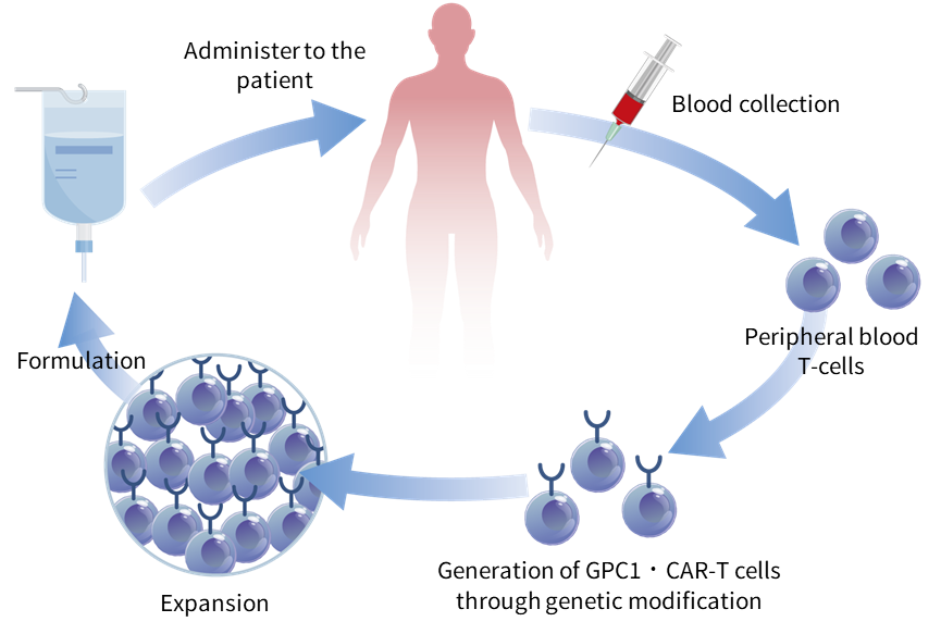 Clinical Pipeline - GPC1 CAR-T therapy