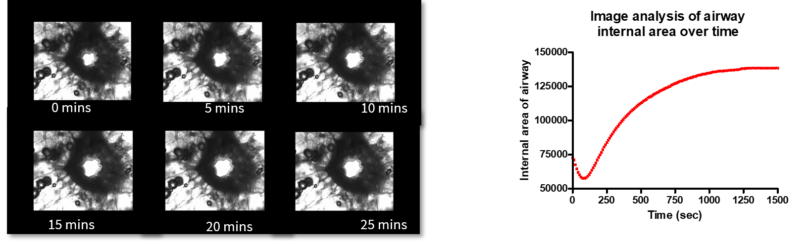 Precision-cut lung slice (PCLS) culture