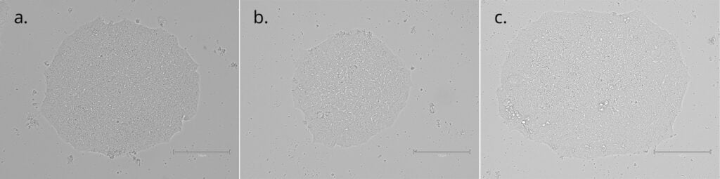 QK120 - Recombinant human Vitronectin protein