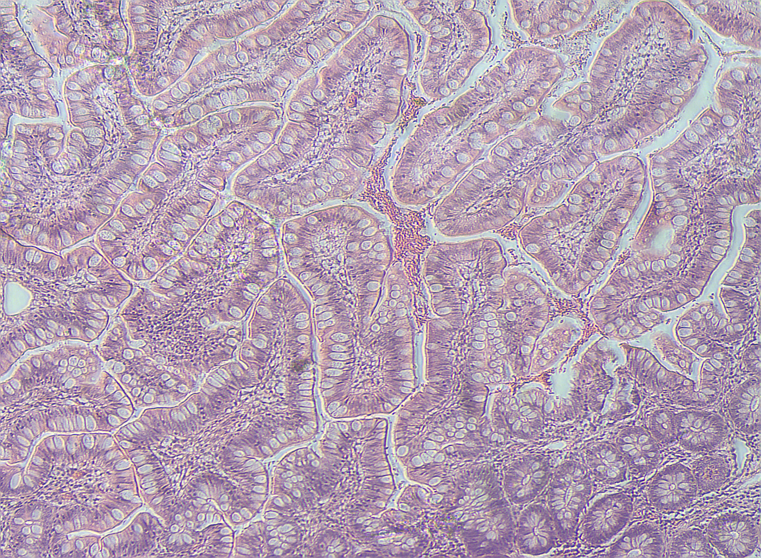 Global Biorepository and Biobank of Human Tissue Samples