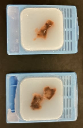 Global Biorepository of Human Tissue Samples