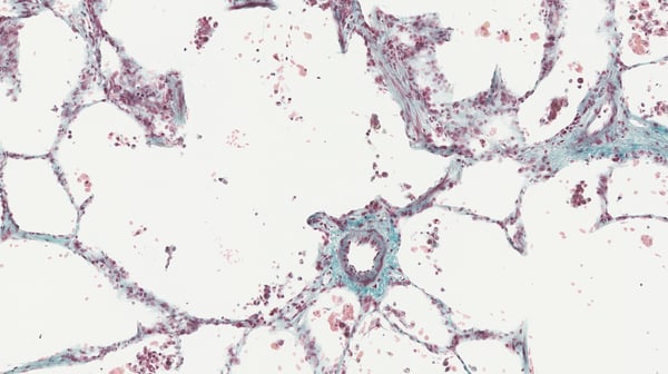 Precision-Cut Lung Slices (PCLS) Research And Assays