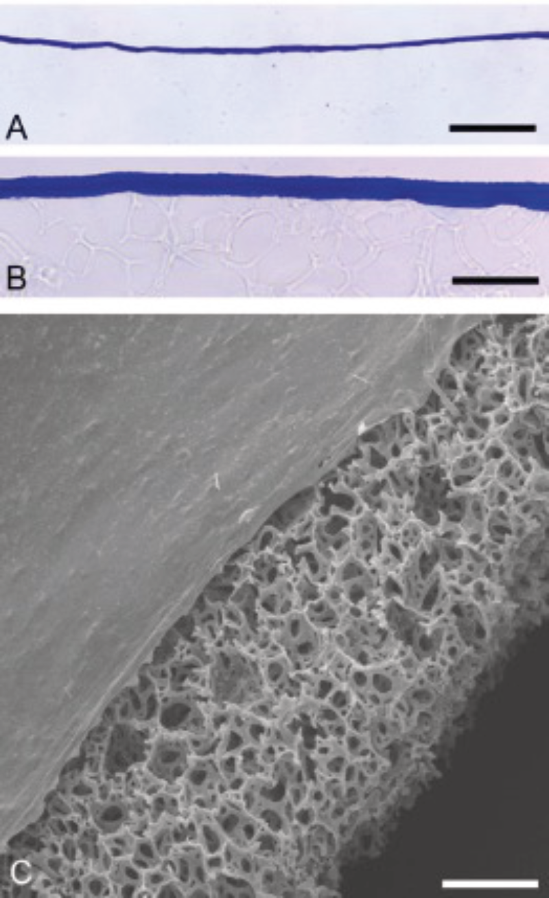 Alvetex Scaffold Protocol: Collagen I Thin Gel Coating