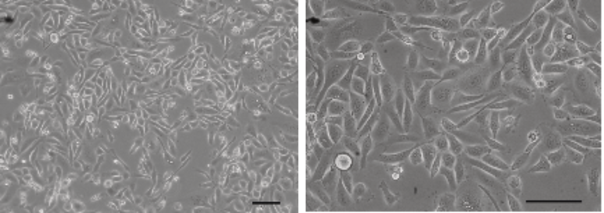 Alvetex Scaffold Protocol: PC-3 Cell Line (Inserts and Plates)