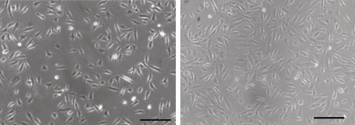 Alvetex Scaffold Protocol: LN-229 Cell Line (96 Well Plates)