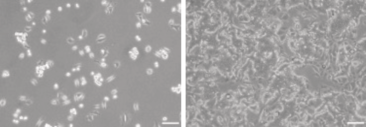 Alvetex Scaffold Protocol: SW480 Cell Line (Inserts & Plates)