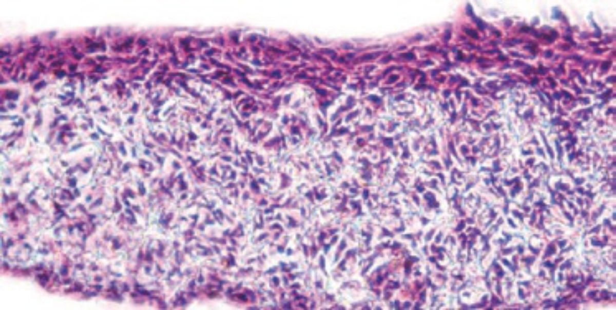 Alvetex Scaffold Protocol: Histology: Choosing the Right Fixative