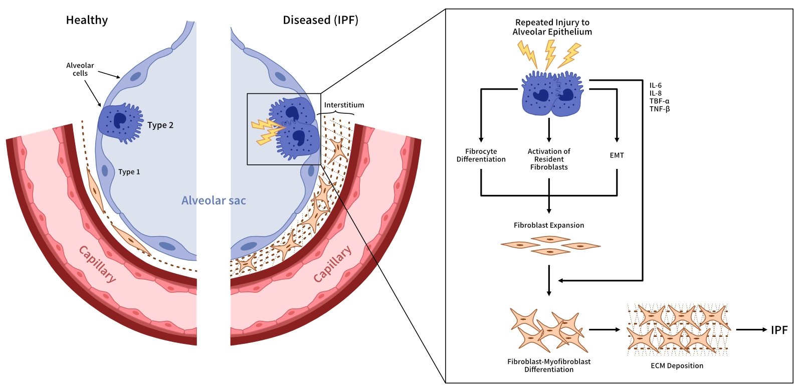 Bioengineered 3D Human IPF Models & Cell Culture Solutions
