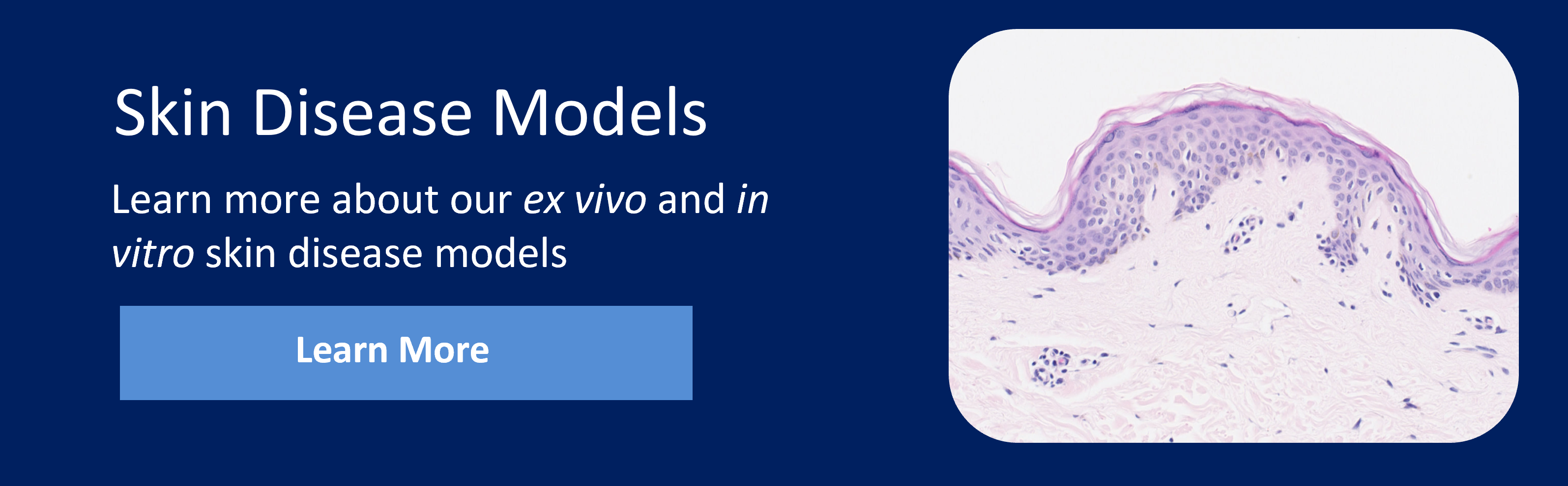 Skin biopsy and ex vivo culture methods