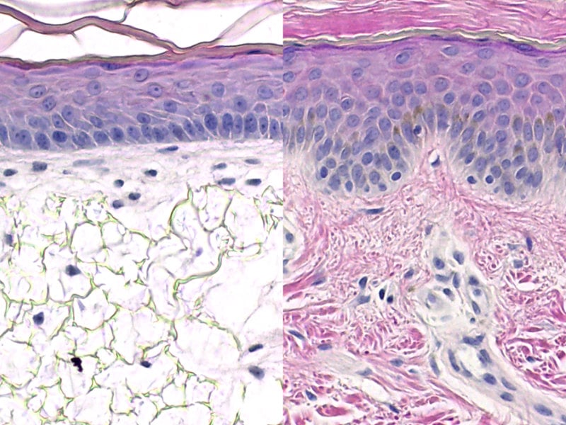 Skin Disease Model, Research Assays, And Testing CRO