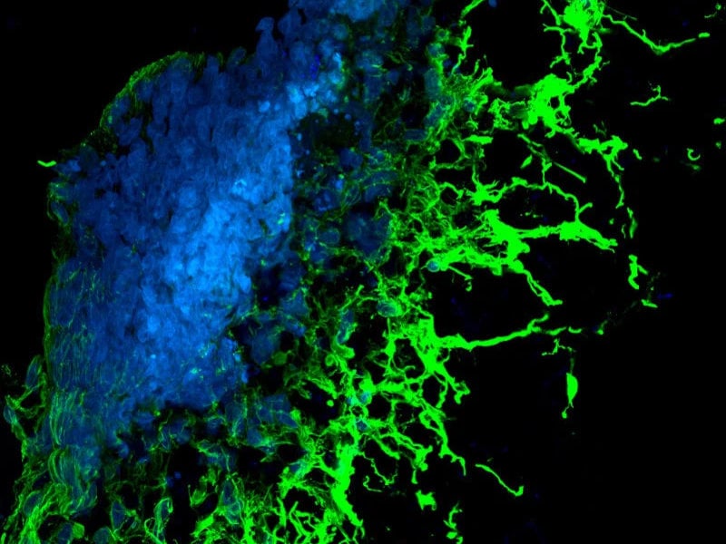 Bioengineered 3D Human Tissue Models & Cell Culture Solutions