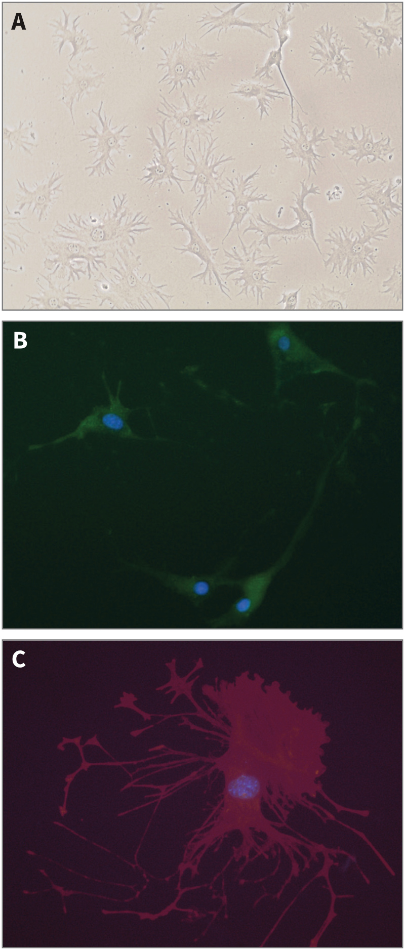 Alvetex 3D Cell Culture of Osteocytes in Simulated Microgravity