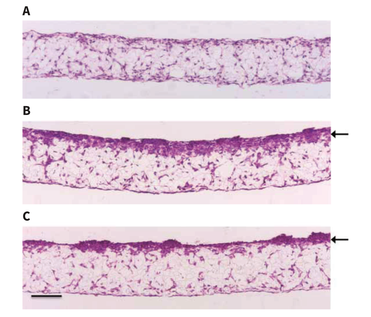 Modelling Cancer Cell Migration and Invasion in Alvetex 3D cell culture