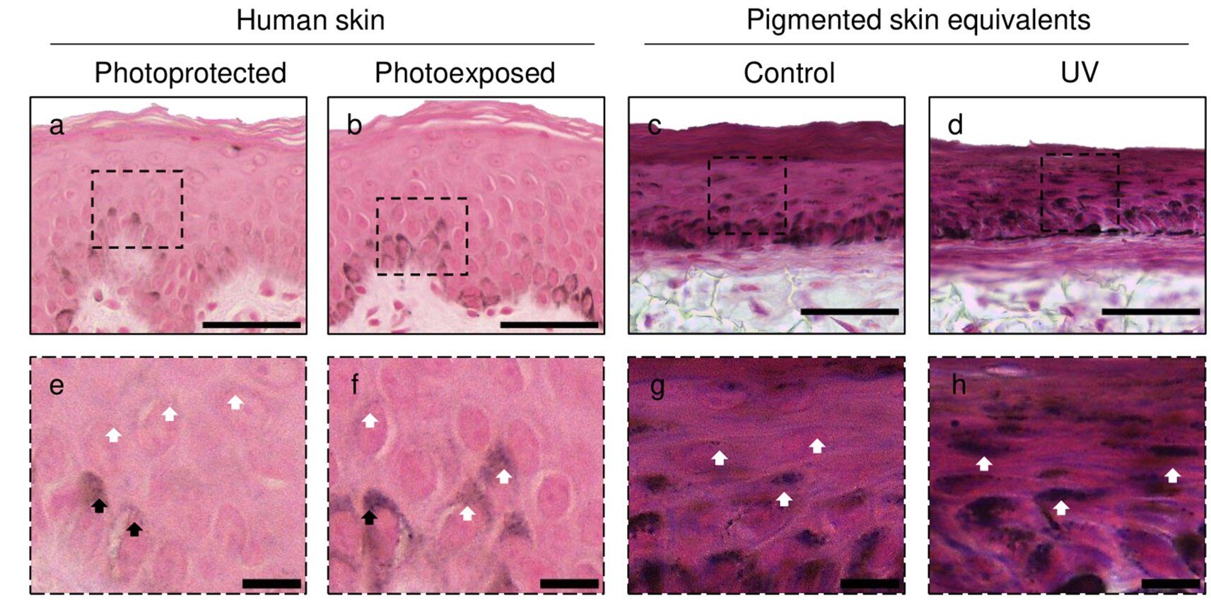 Engineered Pigmented Skin Equivalents Reveal UV Protection Mechanisms
