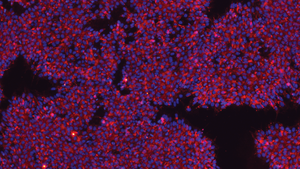 Custom iPSC Reprogramming, Differentiation & Gene‑Editing Services