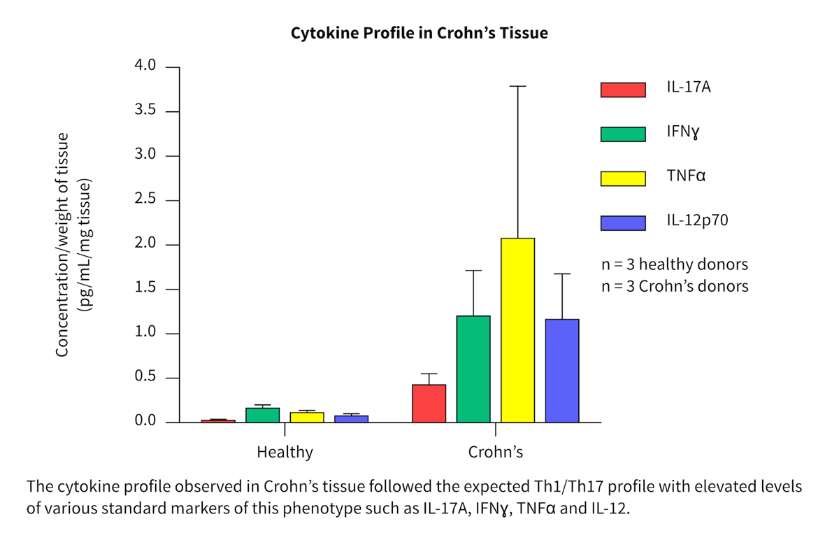 IBD culture study Crohn’s or ulcerative colitis (UC)