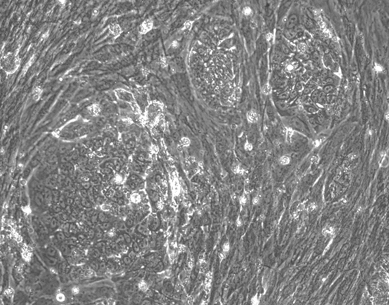 How we established an in vitro Parkinson’s Disease model