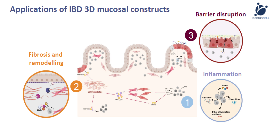 Revolutionizing IBD Research with Innovative In Vitro Models