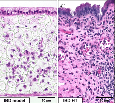 Revolutionizing IBD Research with Innovative In Vitro Models
