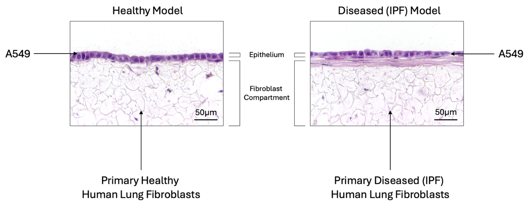 3D Bioengineered model of idiopathic pulmonary fibrosis (IPF)