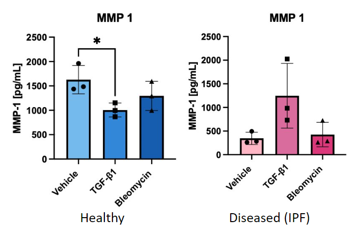Bioengineered 3D Human IPF Models & Cell Culture Solutions