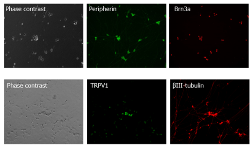 Neuronal Differentiation Services