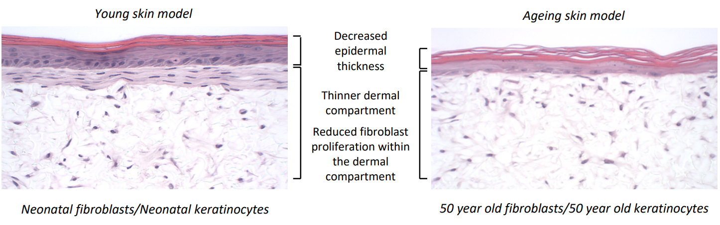 Bioengineered 3D Human Skin Models & Cell Culture Solutions