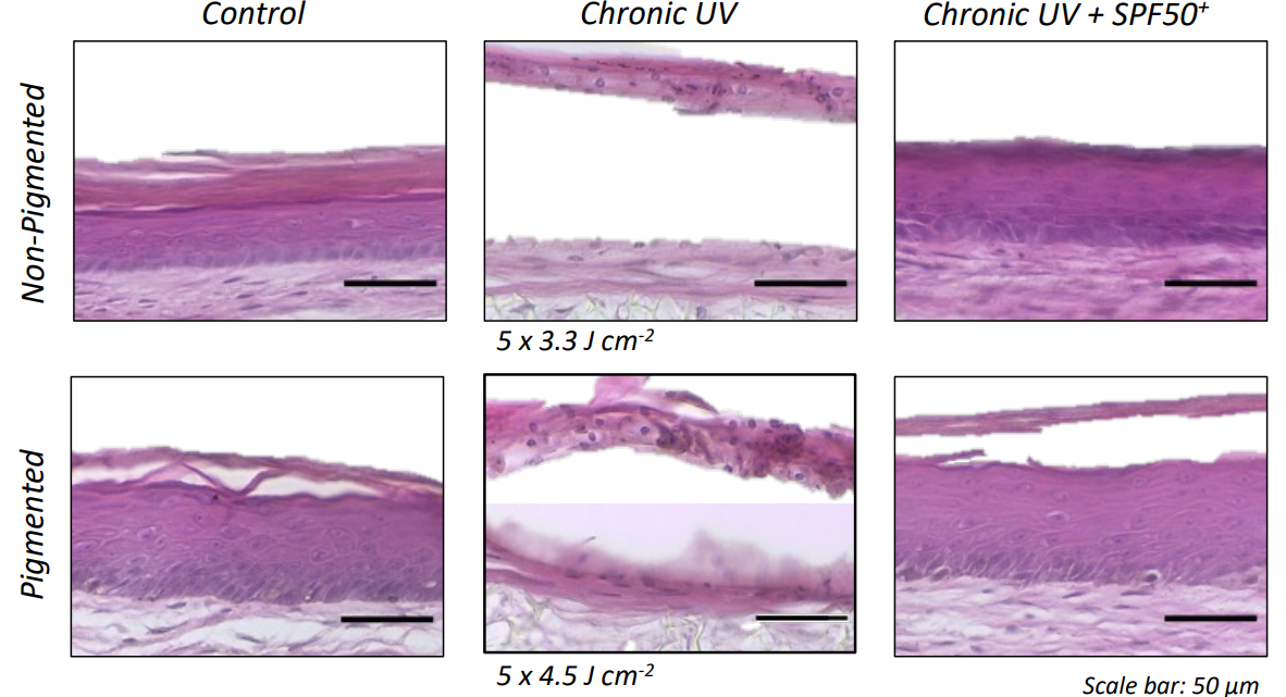 Bioengineered 3D Human Skin Models & Cell Culture Solutions
