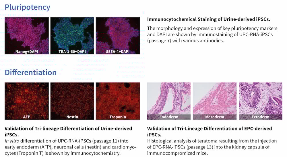 iPSC Stem Cell Expansion, Characterization and Banking