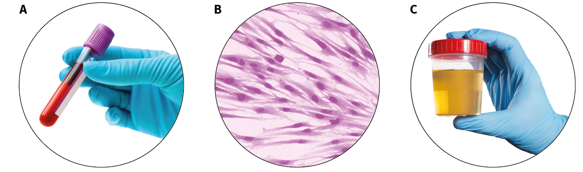 Target Cell Isolation