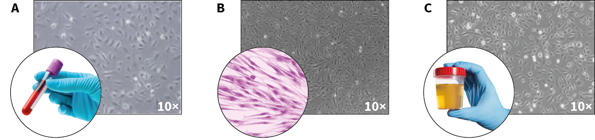 Target Cell Isolation