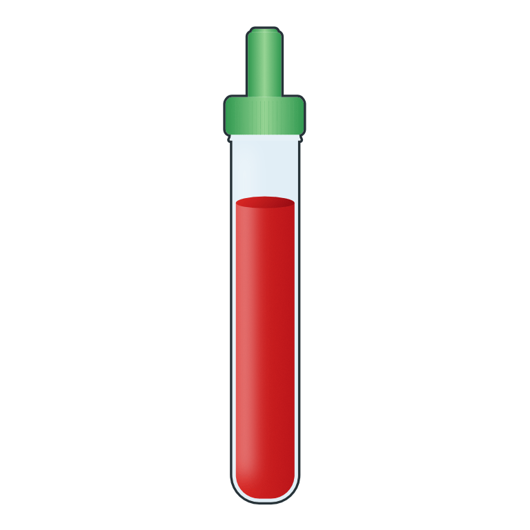 How to isolate PBMCs from whole blood using density gradient centrifugation