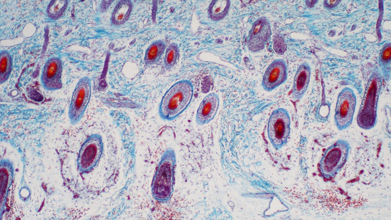 Predicting Psoriasis Drug Efficacy in Human Skin [Infographic]