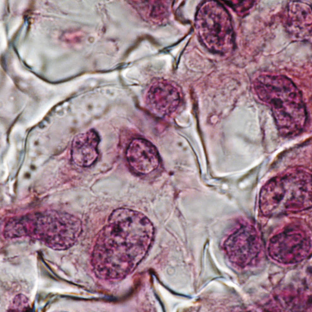 Alvetex Testimonials