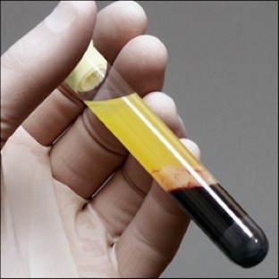 Human Tissue Experts REPROCELL Launch New Customized Primary Cell ...