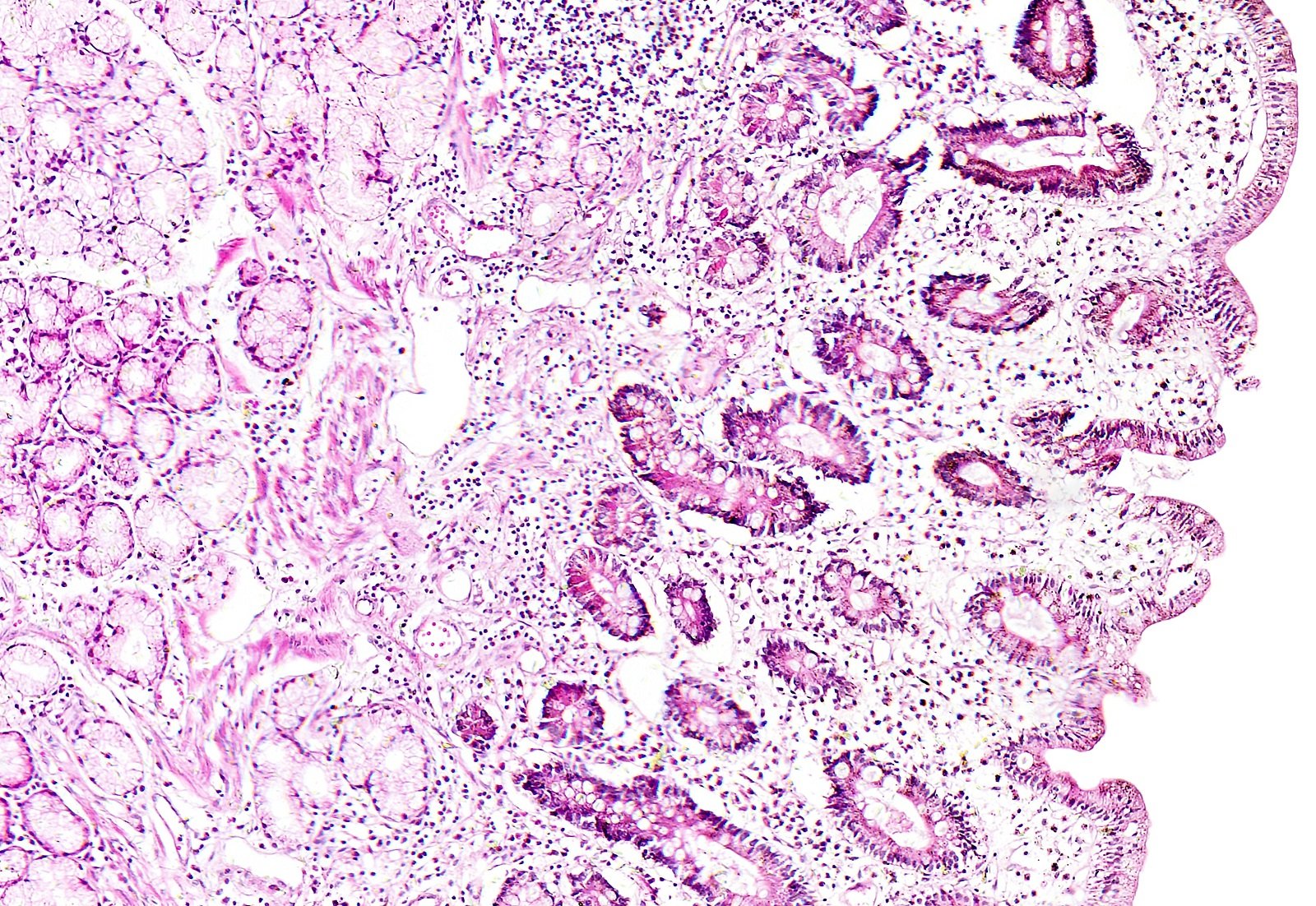 How to Characterize the Barrier Properties of Alvetex®-Based Mucosal Models